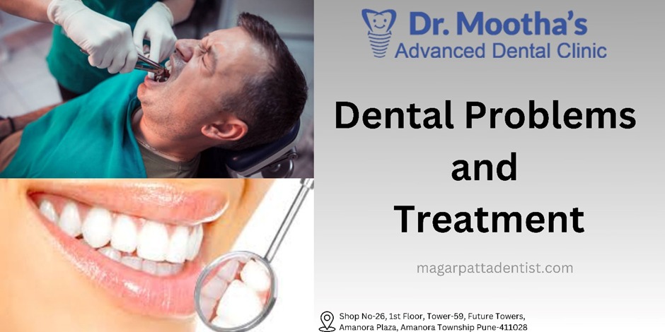 Dental problems and treatment in pune